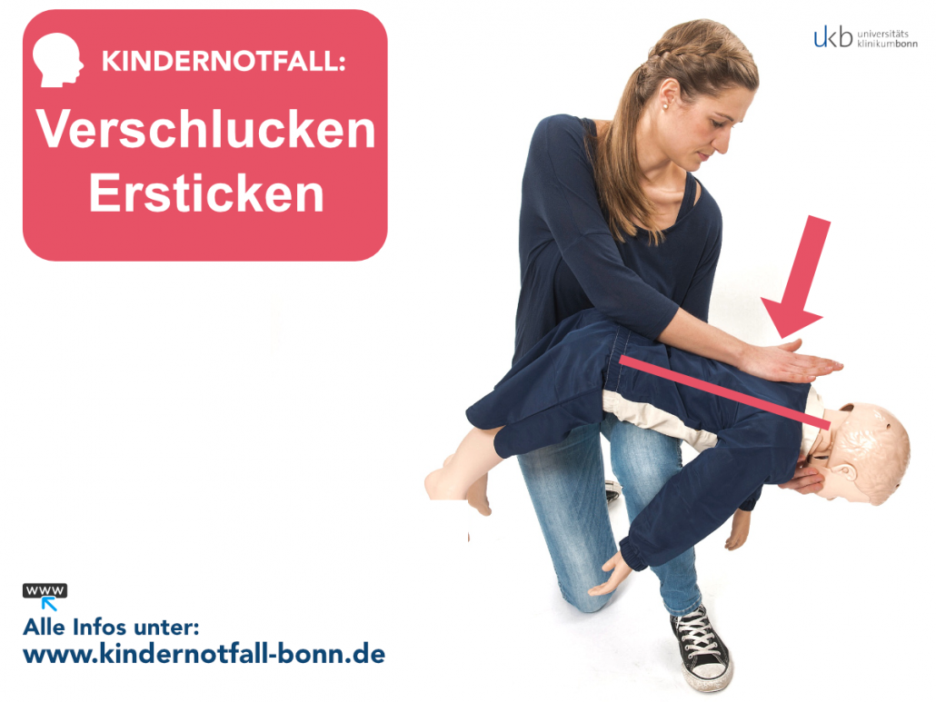 Verschlucken/Ersticken beim Kind | Kindernotfall Bonn - Erste Hilfe am Kind