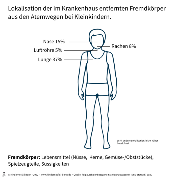 Ersticken/Verschlucken - Erste Hilfe beim Kind.